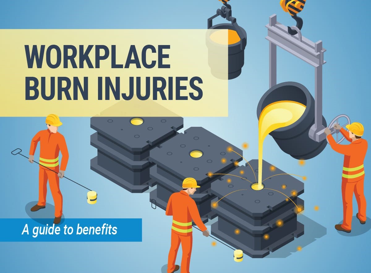 Workplace Burn Injuries - A Guide to Benefits Infographic - Jason M ...